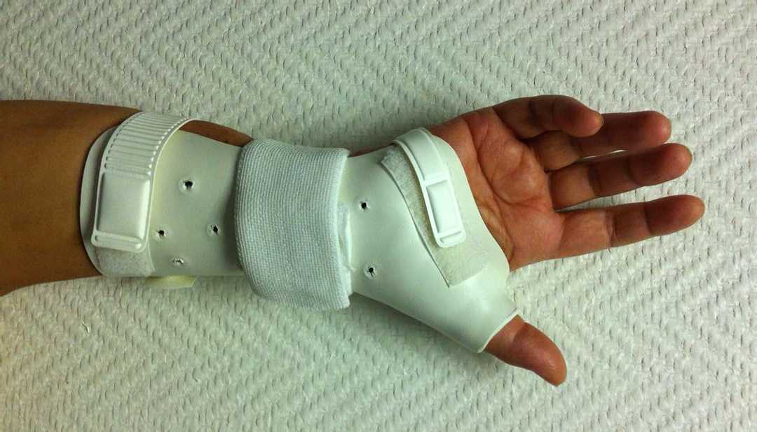 Orthèses thermoformables sur mesure de la main et du membre supérieur