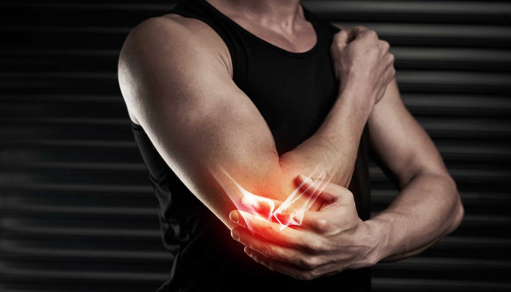 Chirurgie du coude à Paris - Dr Philippe Roure